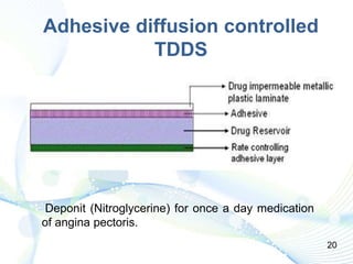 TDDS by Nitin Sonar | PPT