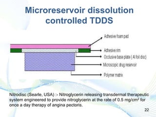TDDS by Nitin Sonar | PPT