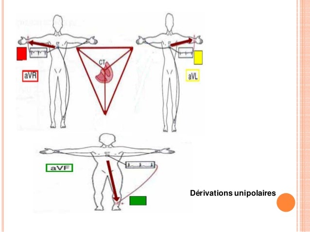 Td ecg dr saadi (diapo)