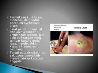 Apa itu kusta (1) | PPTX