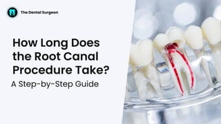 How Long Does a Root Canal Take? A Step-by-Step Patient Guide | PDF