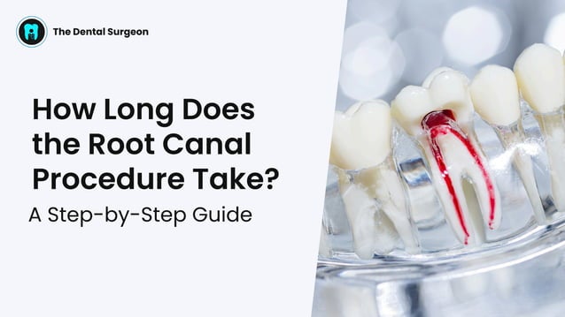 How Long Does a Root Canal Take? A Step-by-Step Patient Guide | PPT