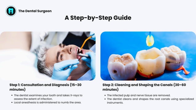 How Long Does a Root Canal Take? A Step-by-Step Patient Guide | PPT