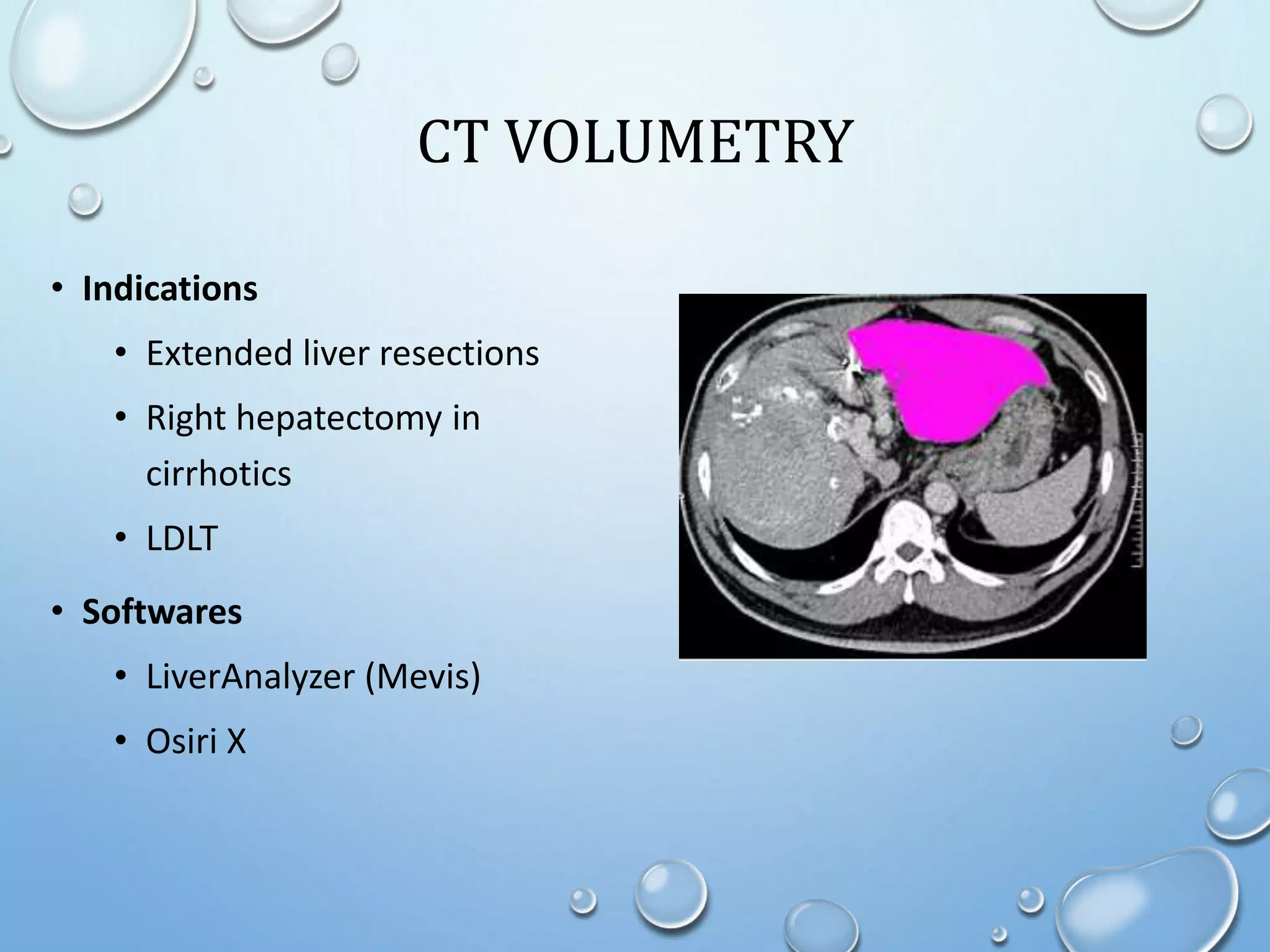 Liver resection indications & methods | PPTX