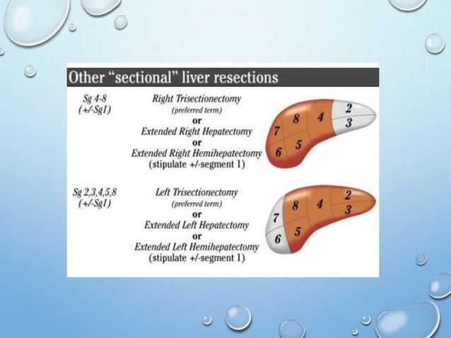 Liver resection indications & methods | PPTX | Blood Disorders ...