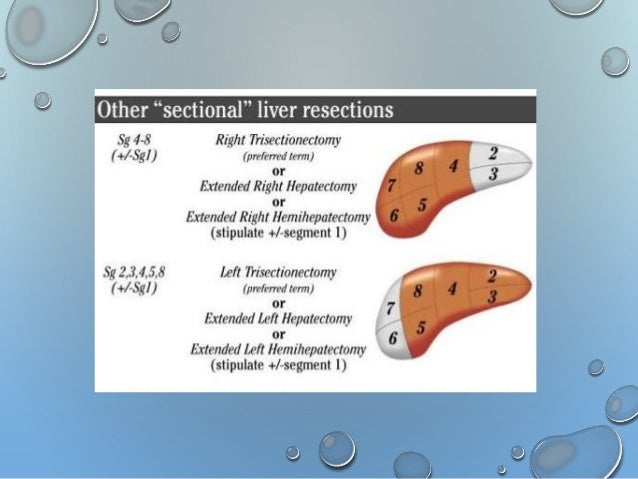 Liver resection indications & methods