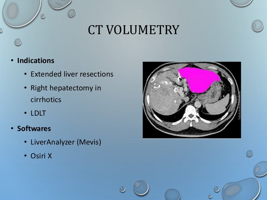 Liver resection indications & methods