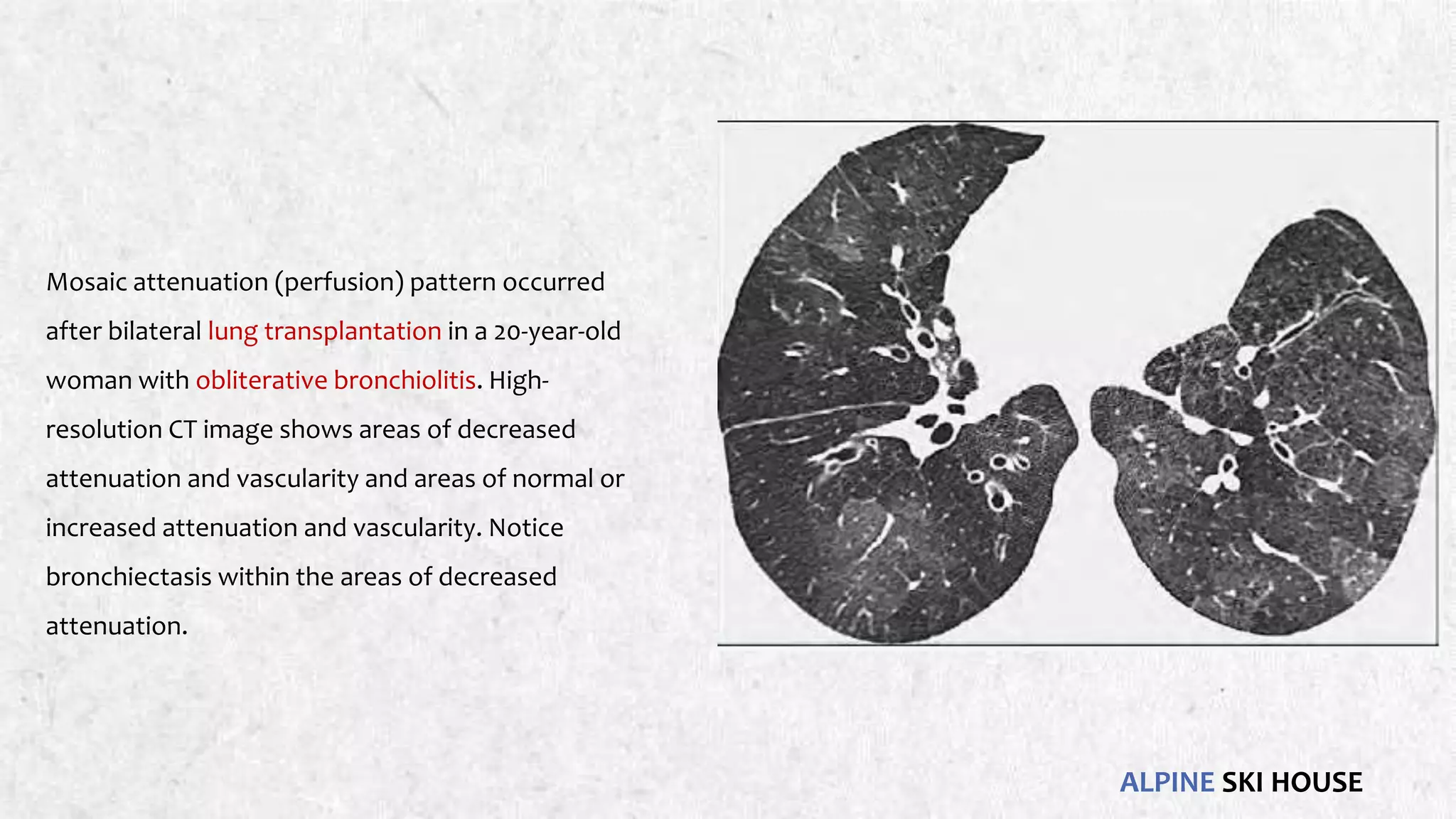 Teaching files chest 2 | PPTX
