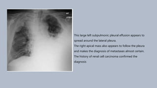 Chest radiology ( pattern and differential diagnosis ) Text book ...