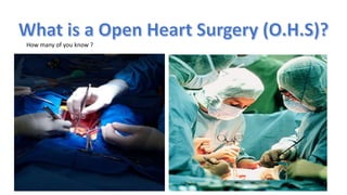 How to perform a Open Heart Surgery | PPT