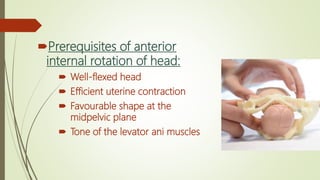 mechanism of labor | PPTX