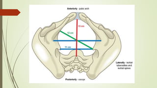 mechanism of labor | PPTX
