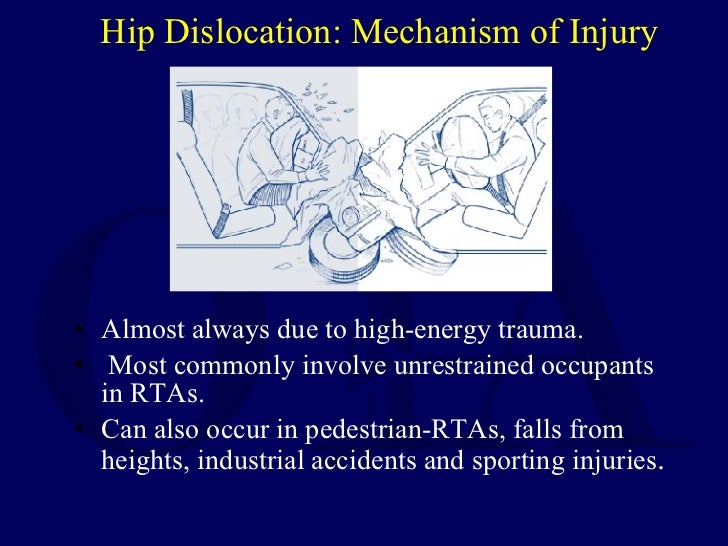 Management of Hip Dislocations