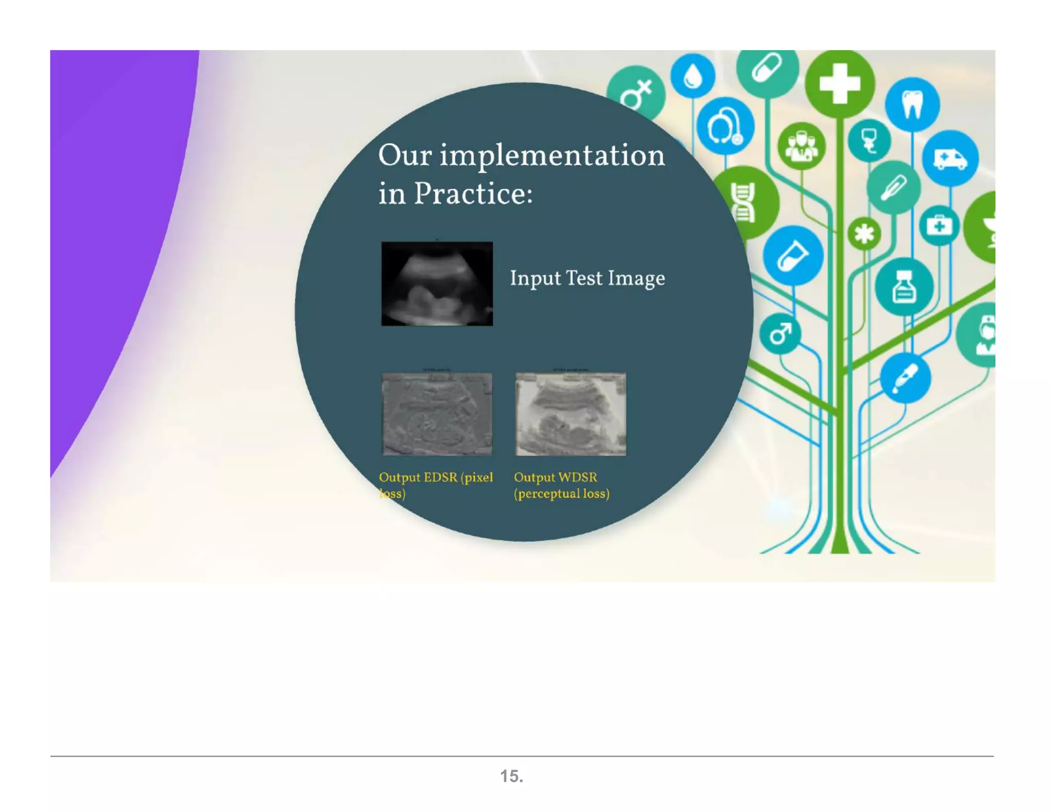 Novel Image Super Resolution Algorithm For Improving Ultrasound Image Quality Ppt