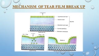 tear film.pptx
