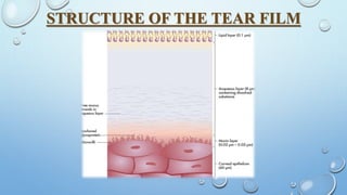 tear film.pptx