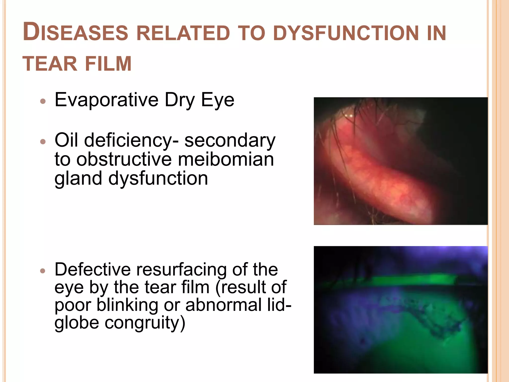 Tear film Dr Ferdous | PPTX