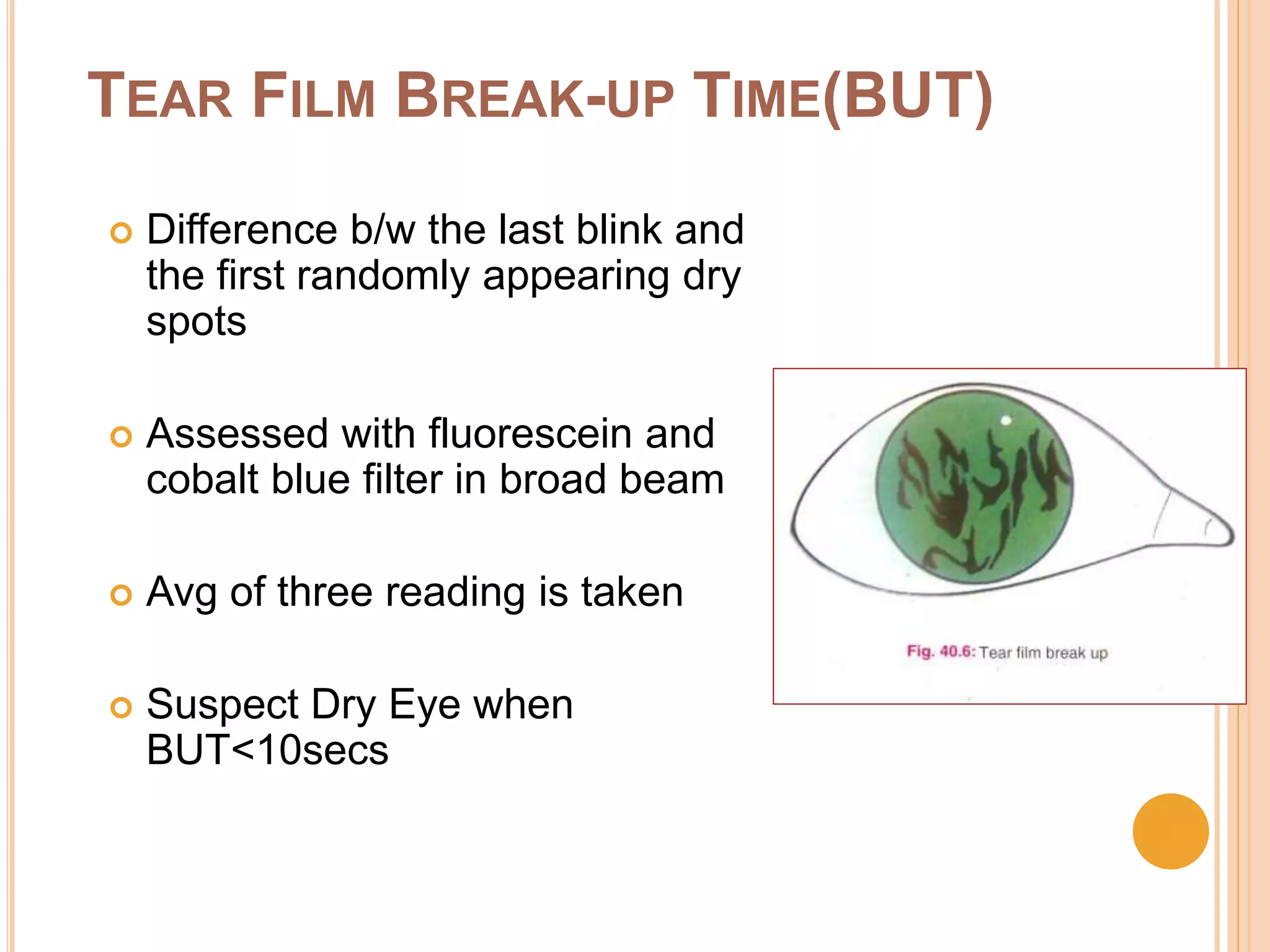 Tear film Dr Ferdous | PPTX