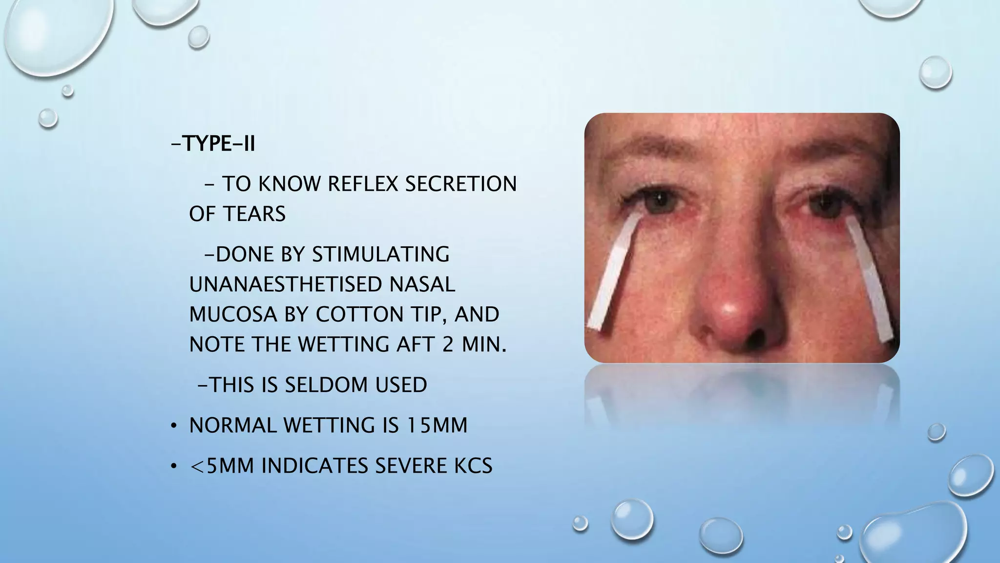 Tear film dynamics | PPTX