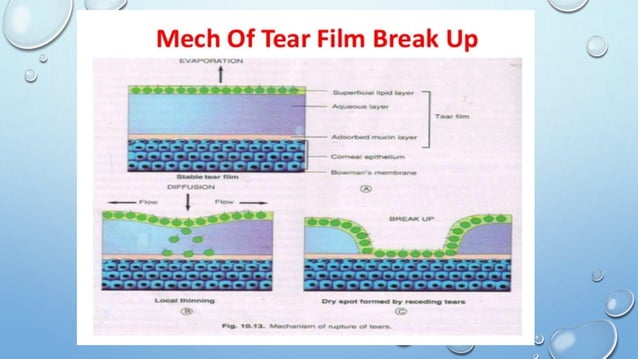 Tear film dynamics | PPTX | Eye and Vision Conditions | Diseases and ...