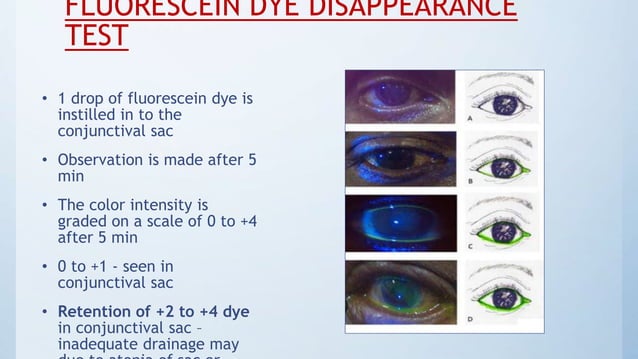 TEAR FILM PHYSIOLOGY Presentation ophthal | PPTX | Eye and Vision ...