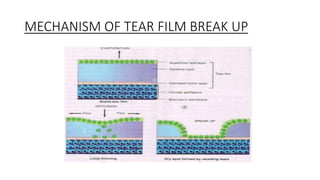 TEAR FILM STRUCTURE AND ITS DYNAMICS BY DR. GUDIYA RANA (1).pptx