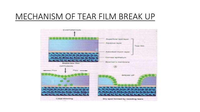 TEAR FILM STRUCTURE AND ITS DYNAMICS BY DR. GUDIYA RANA (1).pptx | Eye ...