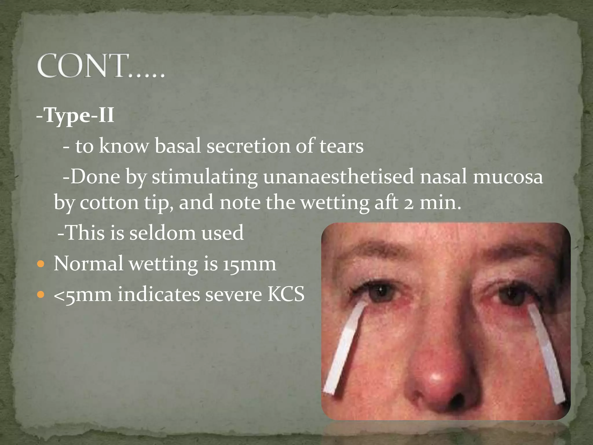 Tear film test | PPTX