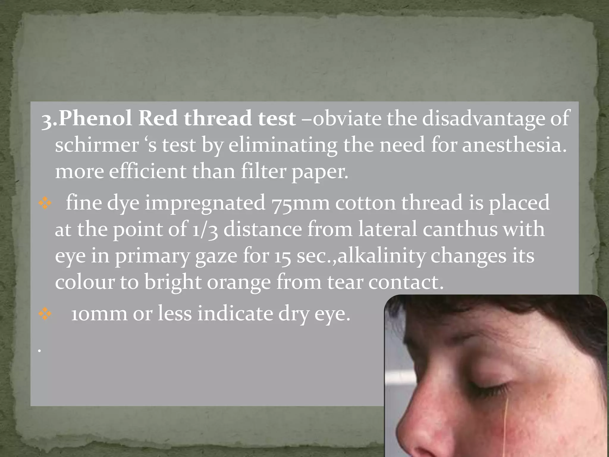 Tear film test | PPTX