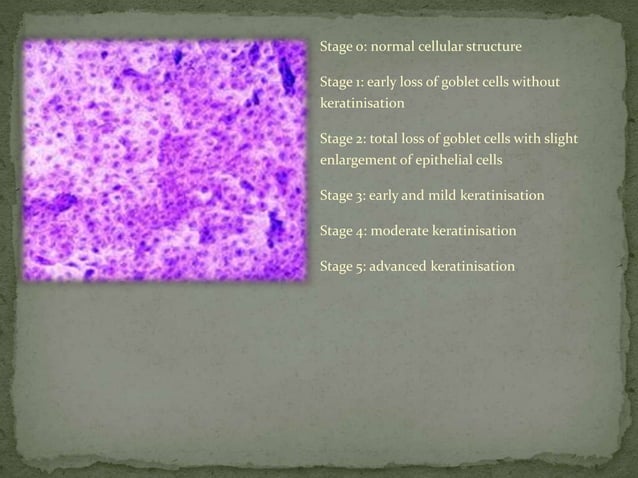 Tear film test | PPTX