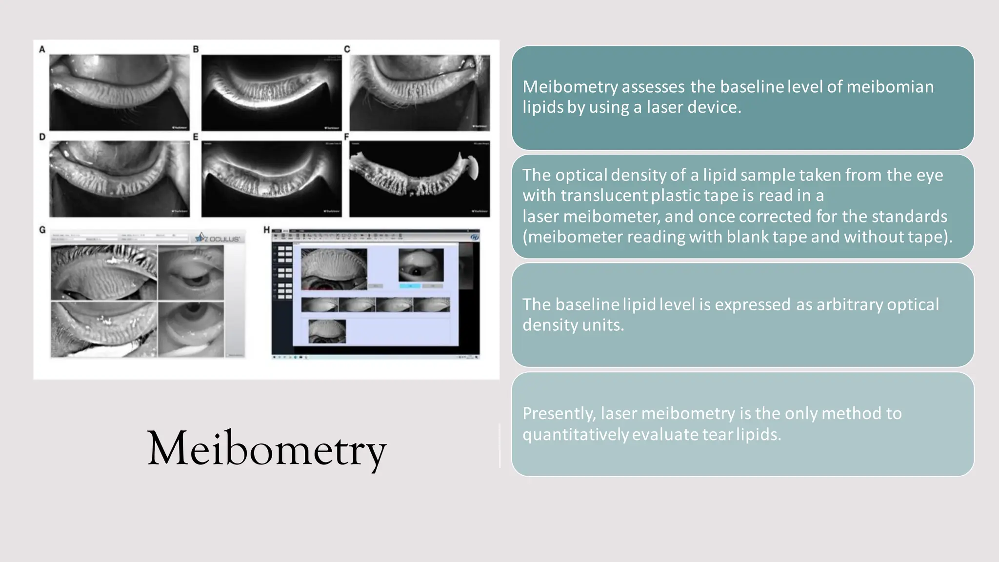 Tear Flim Biochemistry- Ocular biochemistry | PPT