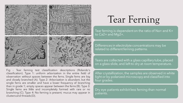 Tear Flim Biochemistry- Ocular biochemistry | PPT