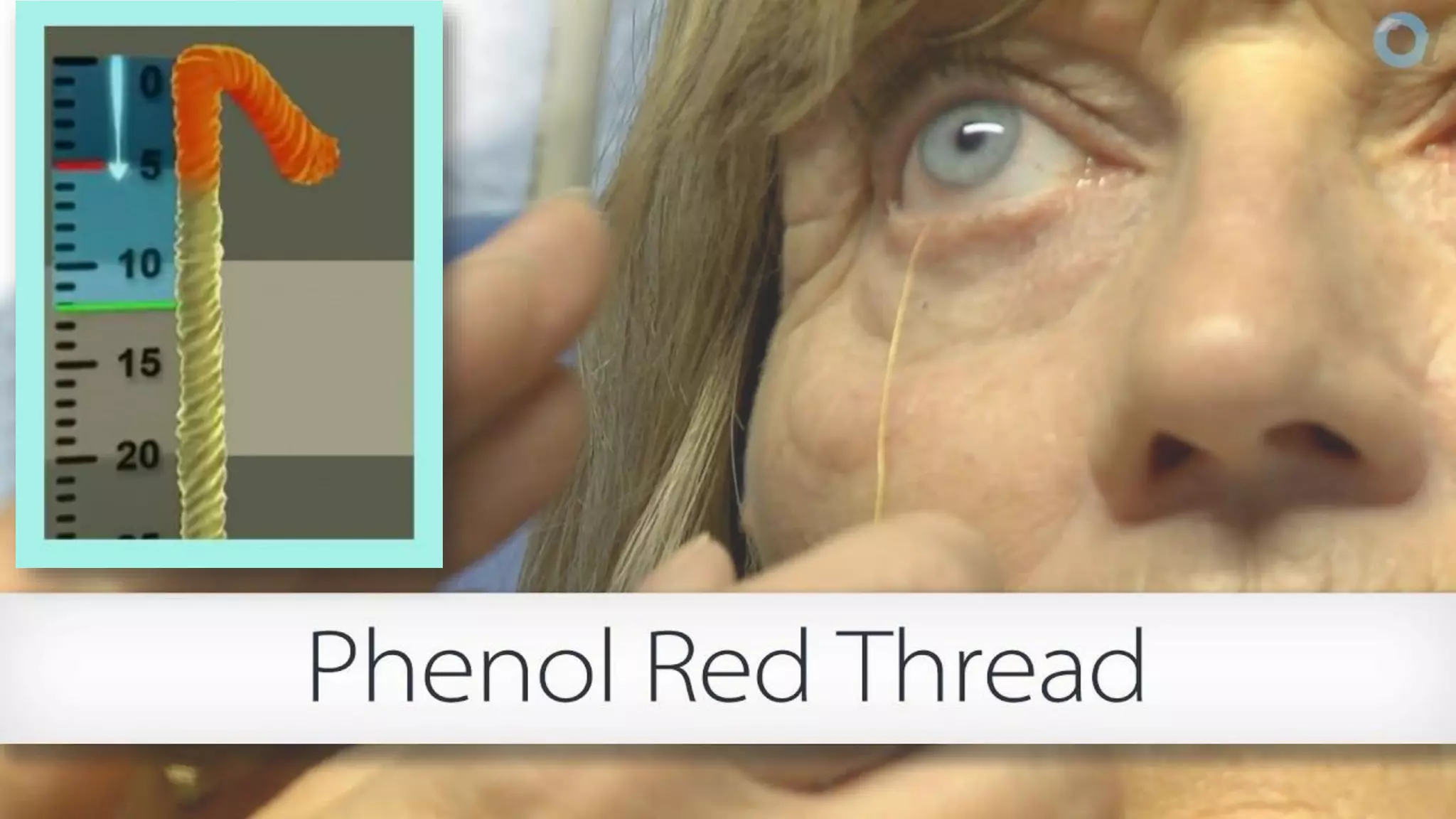 Tear function tests | PPT