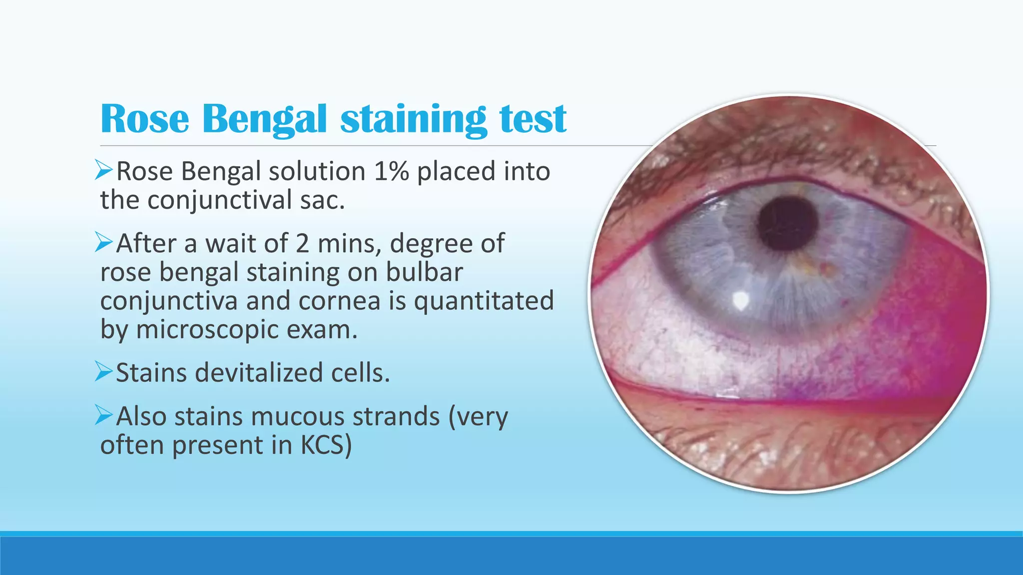 Tear function tests | PDF