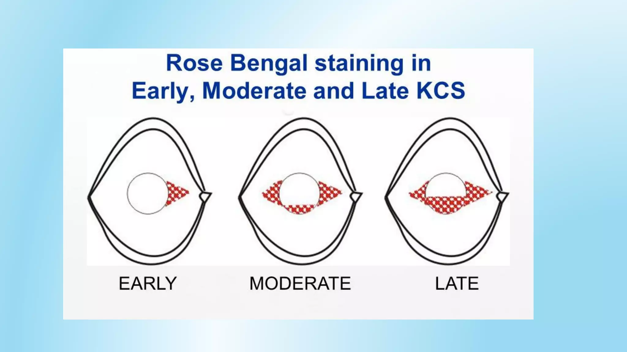 Tear function tests | PDF