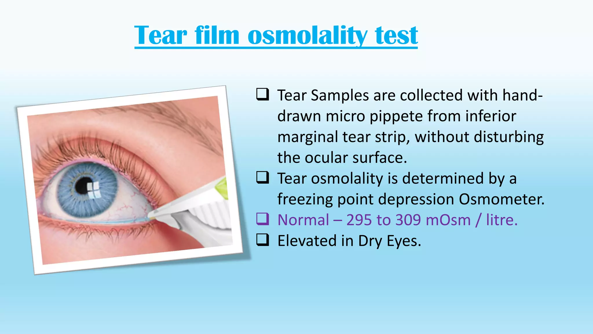 Tear function tests | PDF