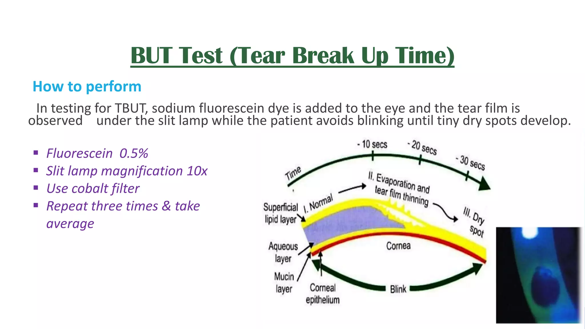 Tear function tests | PDF