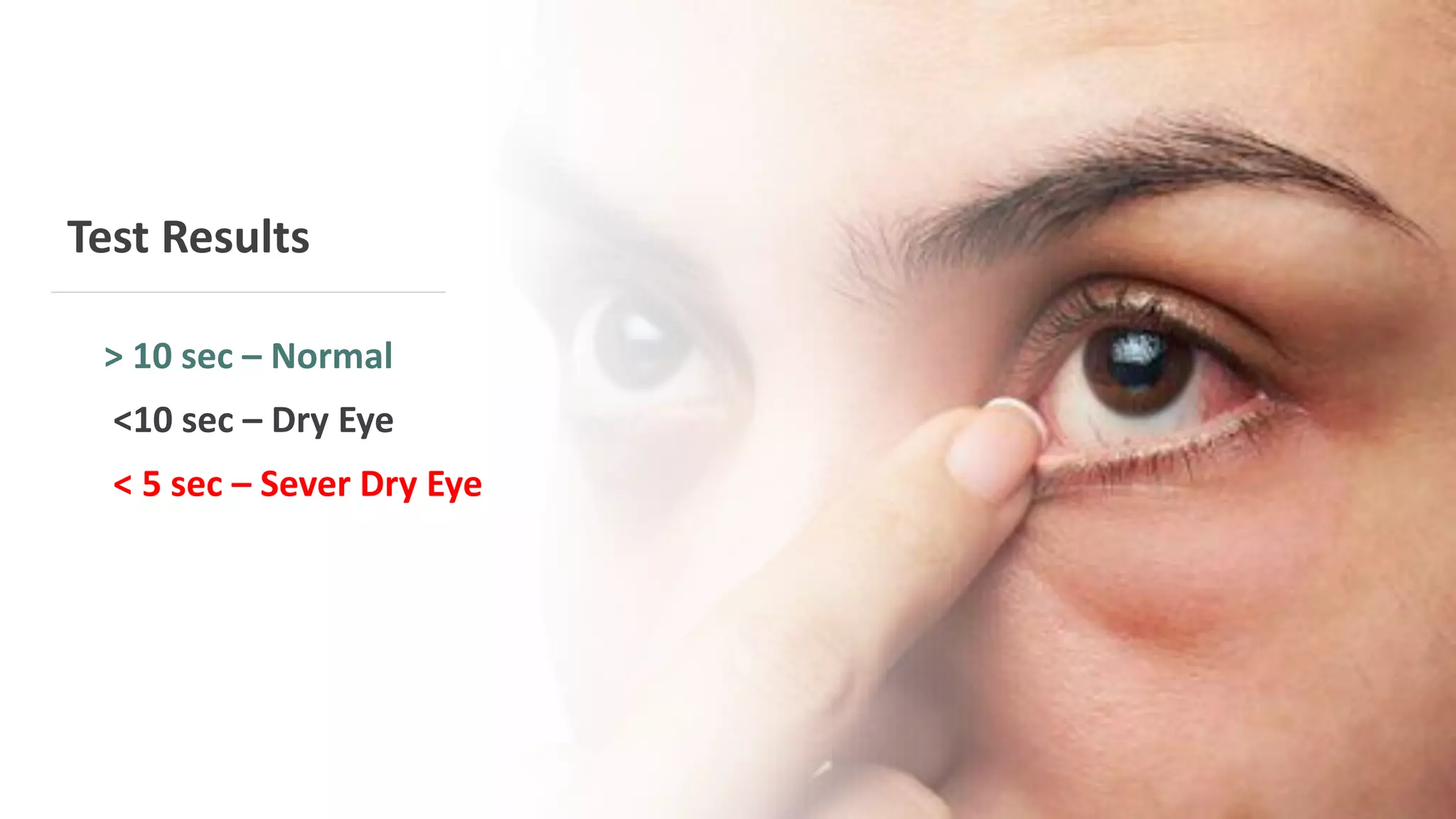 Tear function tests | PDF