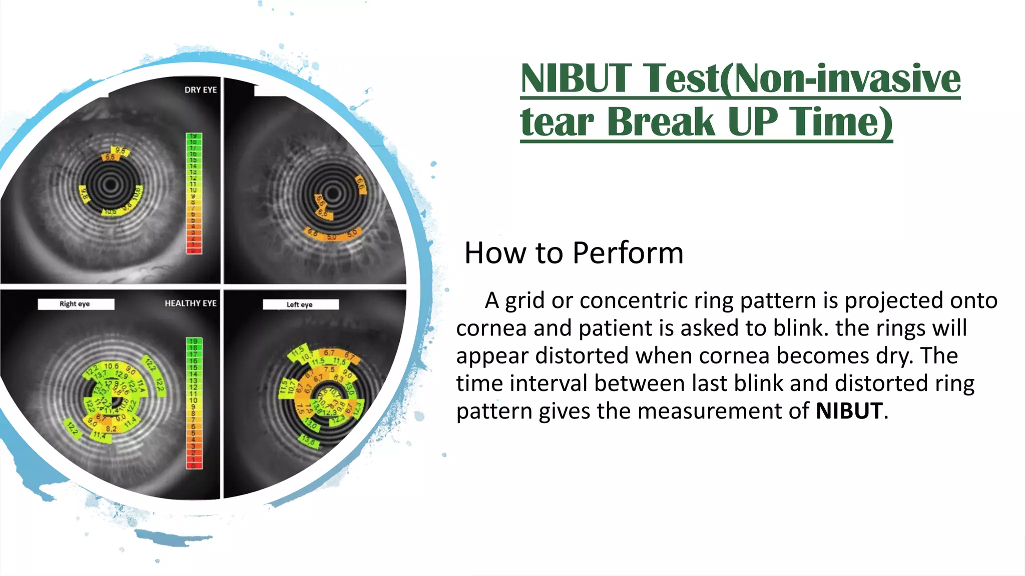 Tear function tests | PDF