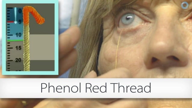 Tear function tests | PDF | Eye and Vision Conditions | Diseases and ...