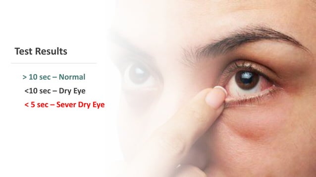 Tear function tests | PDF | Eye and Vision Conditions | Diseases and ...