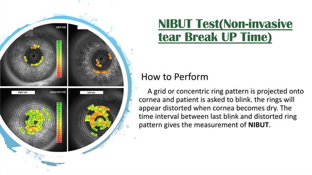 Tear function tests | PDF | Eye and Vision Conditions | Diseases and ...