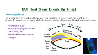 Tear function tests | PPT