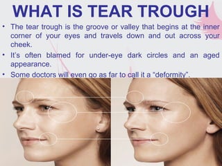 Tear Trough | PPT