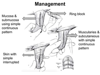 Teat surgery | PPTX | Death, Injury, or Military Conflict | Sensitive ...