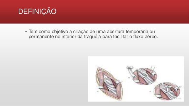 Tecnica cirúrgica veterinária- esofagotomia,traqueostomia e traqueorr…