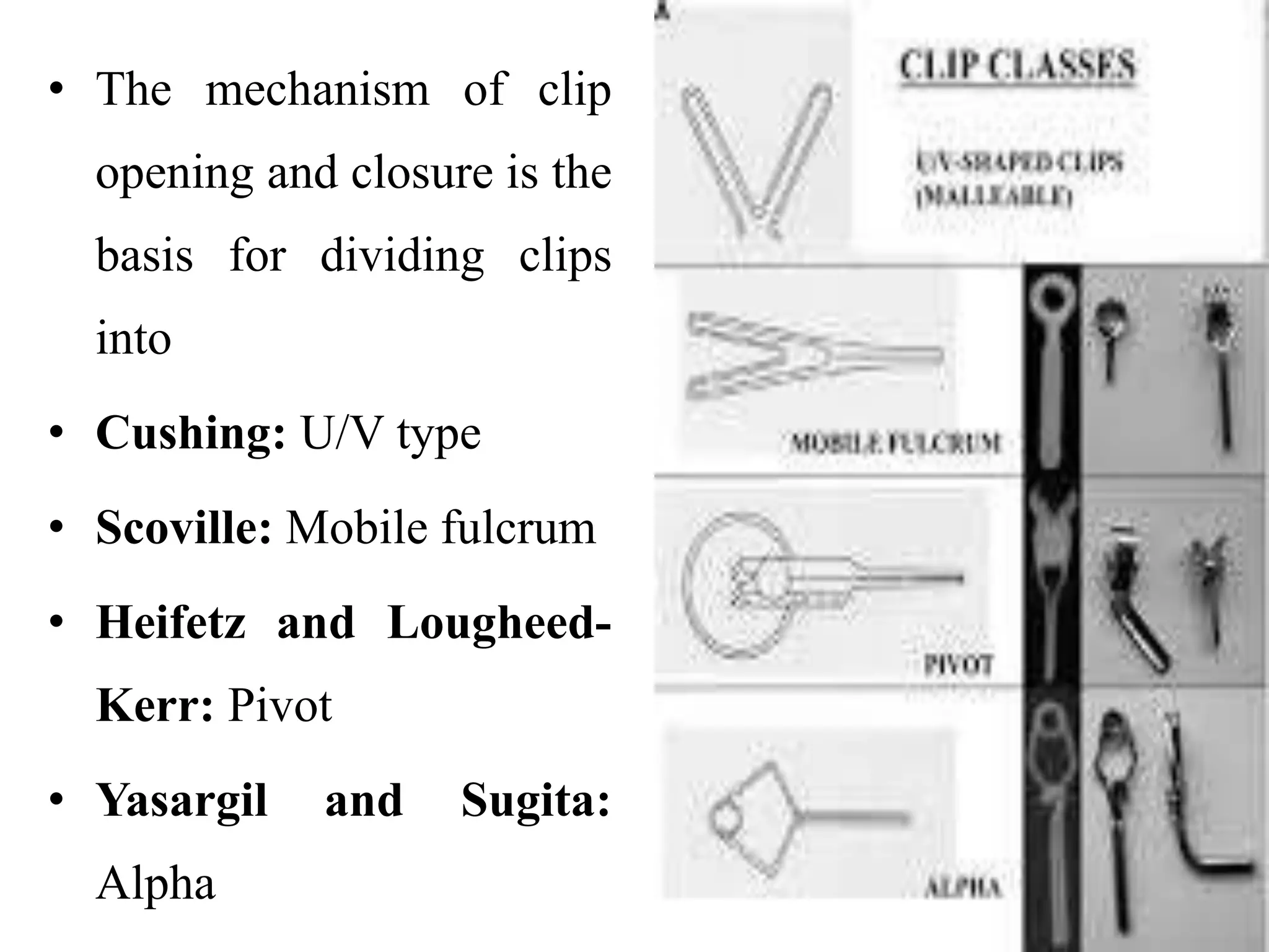 Techiniques of clipping in aneurysm & endovascular option | PPTX