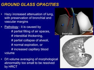 Technical aspect of hrct; normal lung anatomy & hrct findings of lung ...