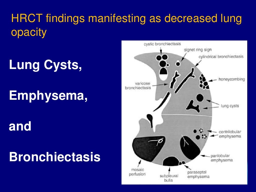 Technical aspect of hrct; normal lung anatomy & hrct findings of lung…