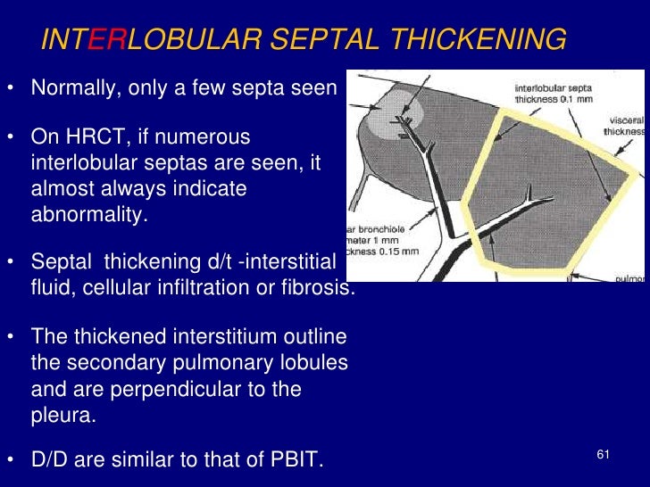 Technical aspect of hrct; normal lung anatomy & hrct findings of lung…